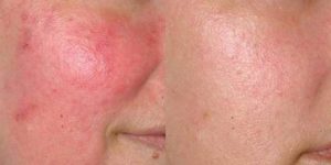 Treatments - Sinclair Dermatology