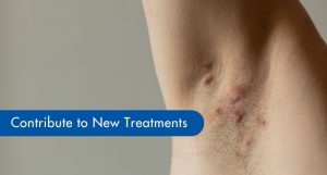 Improving care for hidradenitis suppurativa | Sinclair Dermatology